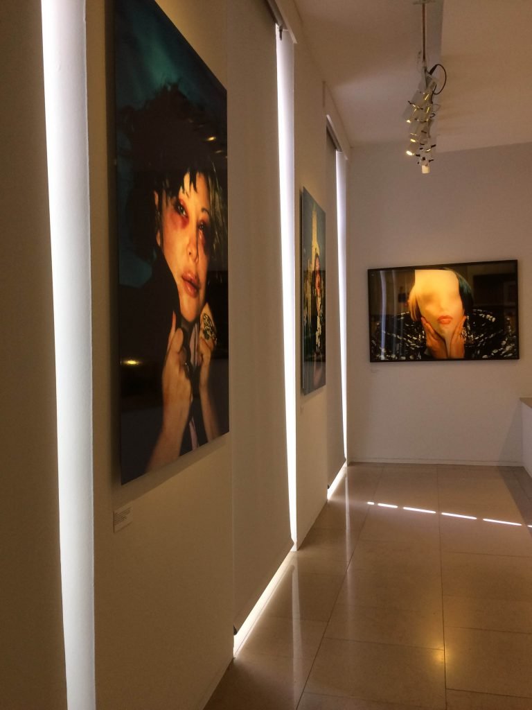 ORLAN surgery recovery – A Shaded View on Fashion